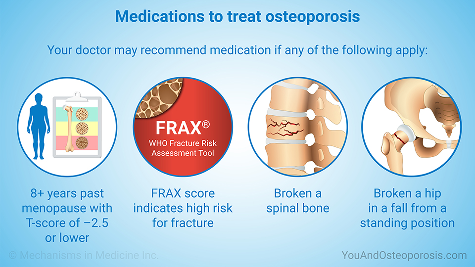 Osteoporosis Treatment Medication